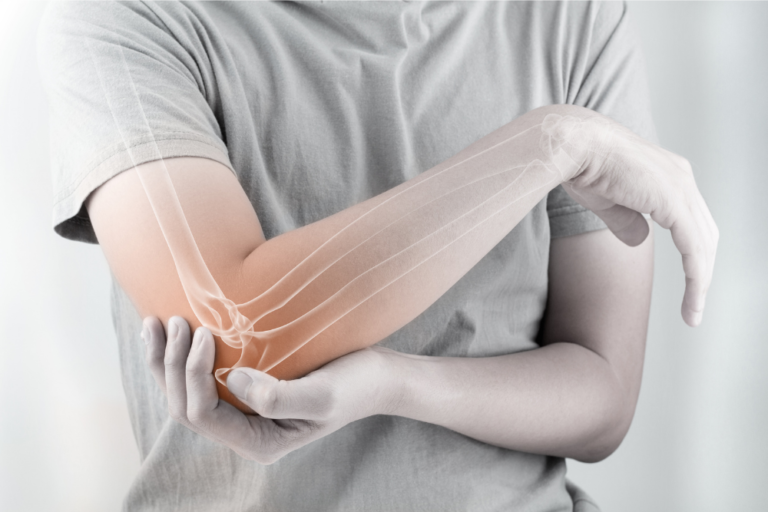 Gluten and Your Muscles, Joints, and Skin - GIG® Gluten Intolerance Group®